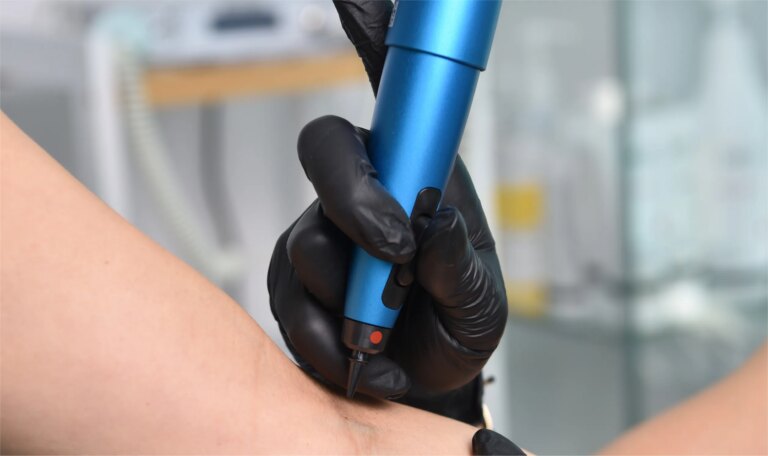 Cryopen - the innovation in the field of dermatology and cosmetology